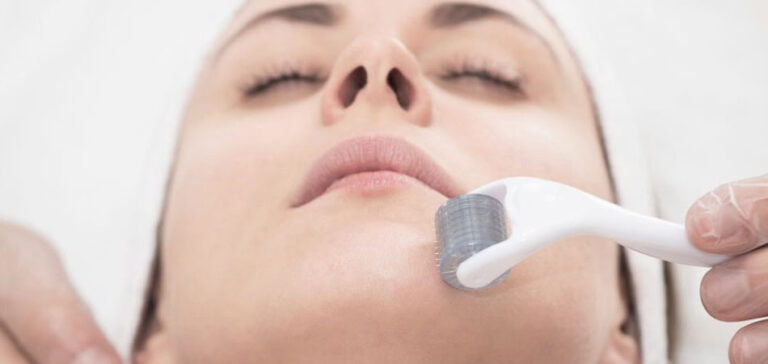 Skin Needling: A Guide to the Procedure and Its Results - Ashleys Skin ...